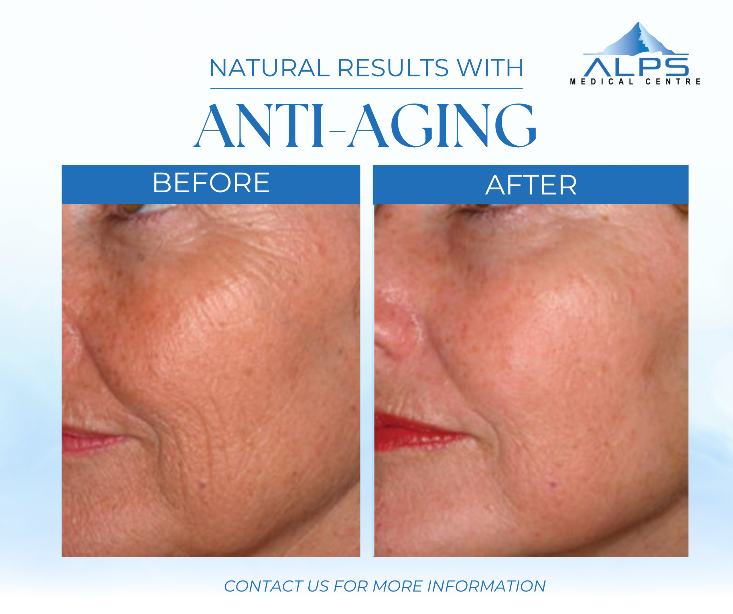 Anti-Aging | ALPS Medical